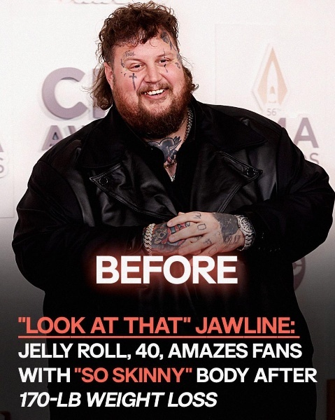 At 40 years old, Jelly Roll is stunning fans with his dramatic ...