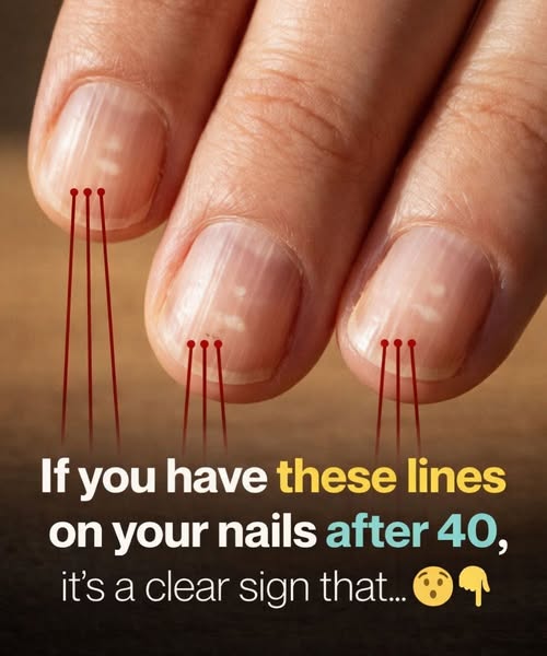 Foods That Help Strengthen Brittle Nails After 40, Improve Growth ...